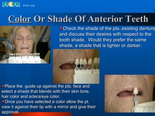 11.anterior tooth selection | PPT | Dental Health | Diseases and Conditions