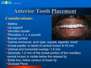 11.anterior tooth selection | PPT | Dental Health | Diseases and Conditions