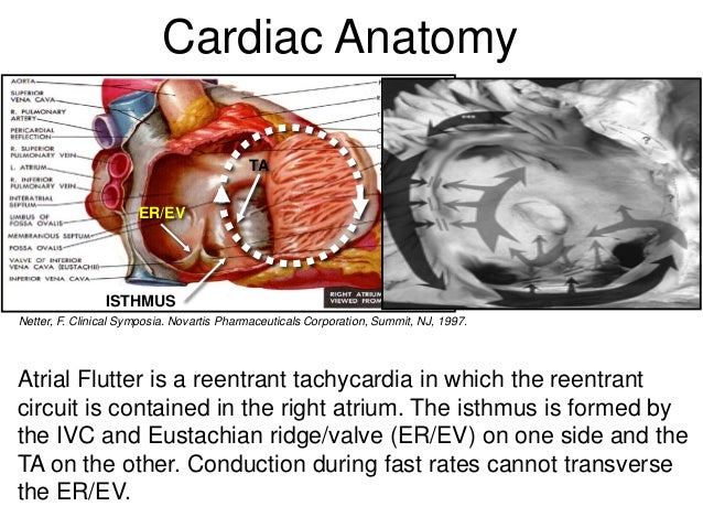 11.atrial flutter for basic ep.final