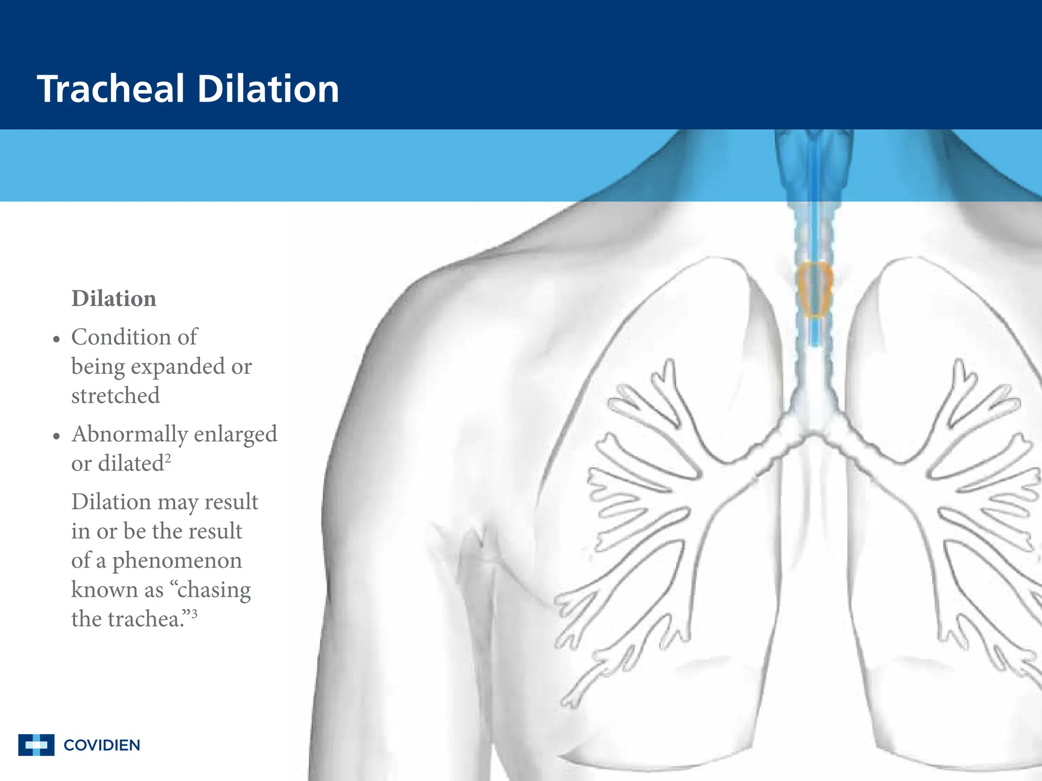 11-AW-0036 SA_ET Intubation and Tracheal Damage.pdf
