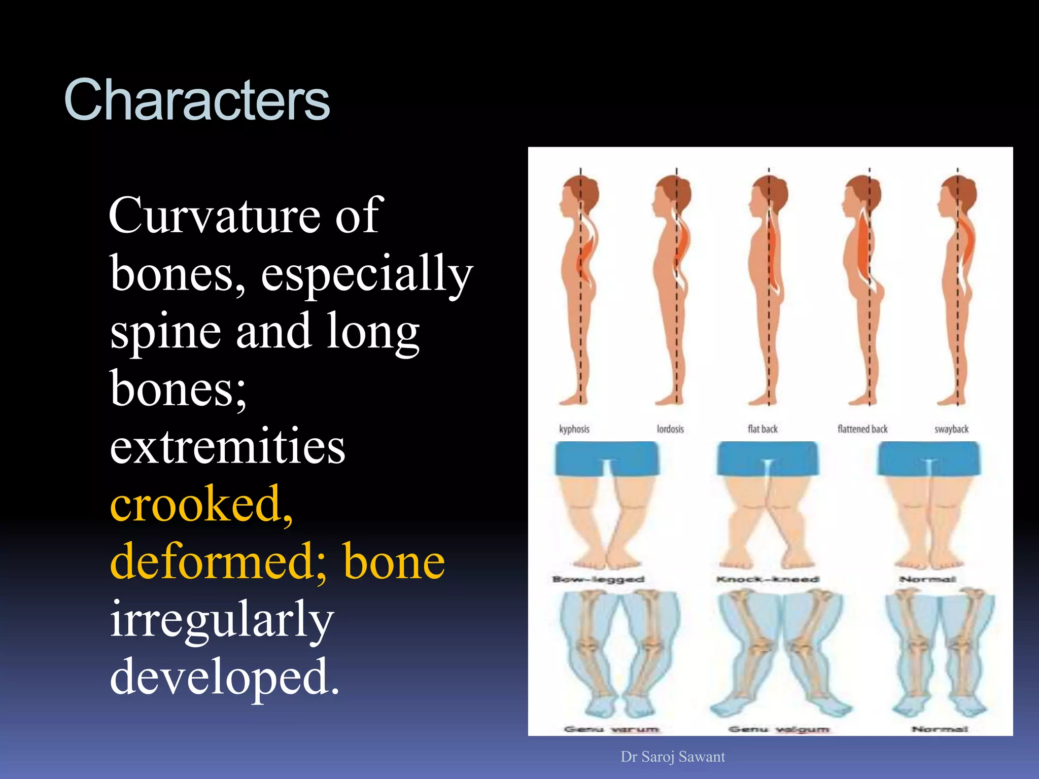 Calcarea Carbonica pptx | PPTX