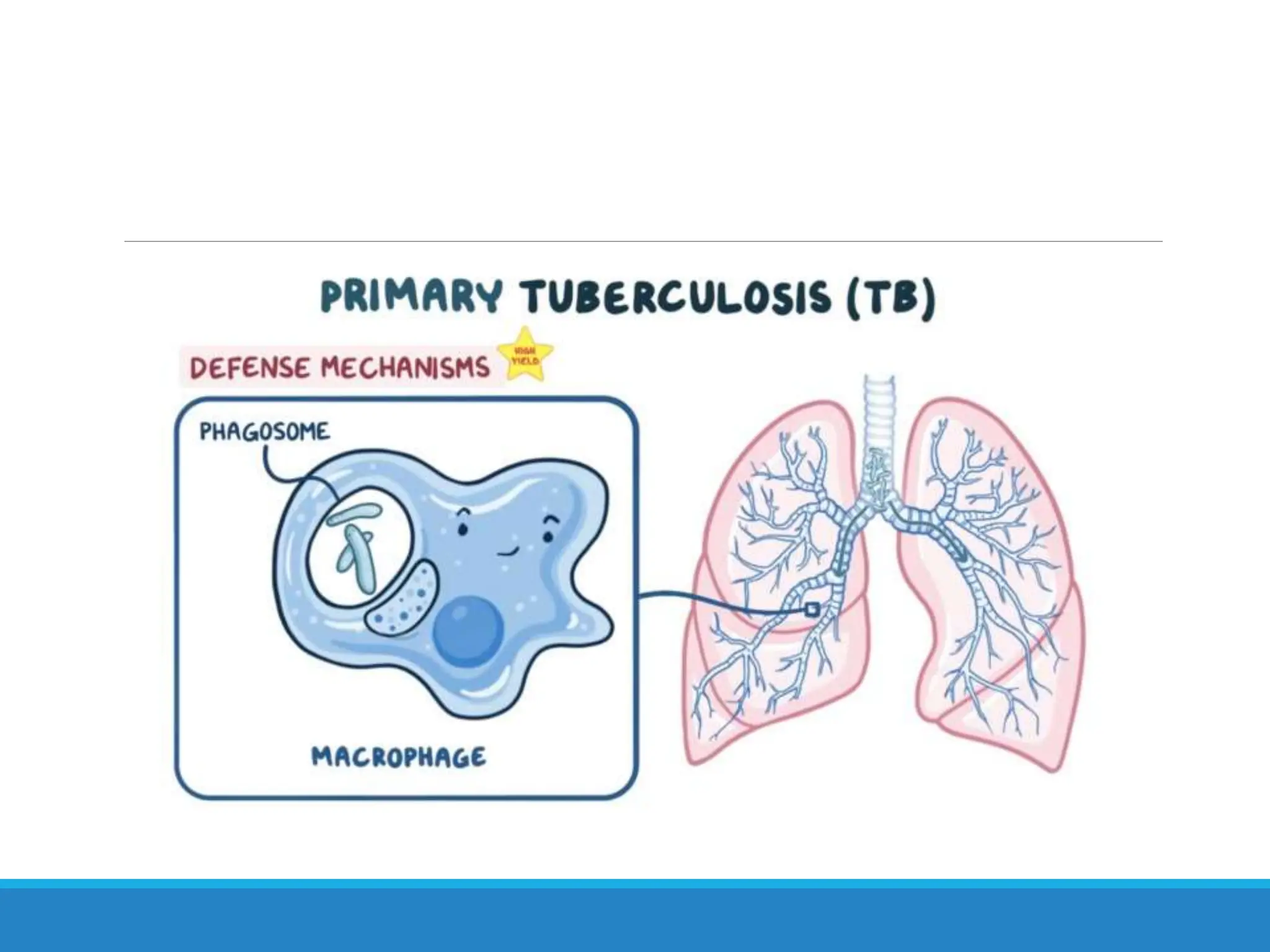11- Chronic inflammations -Tuberculosis.ppt