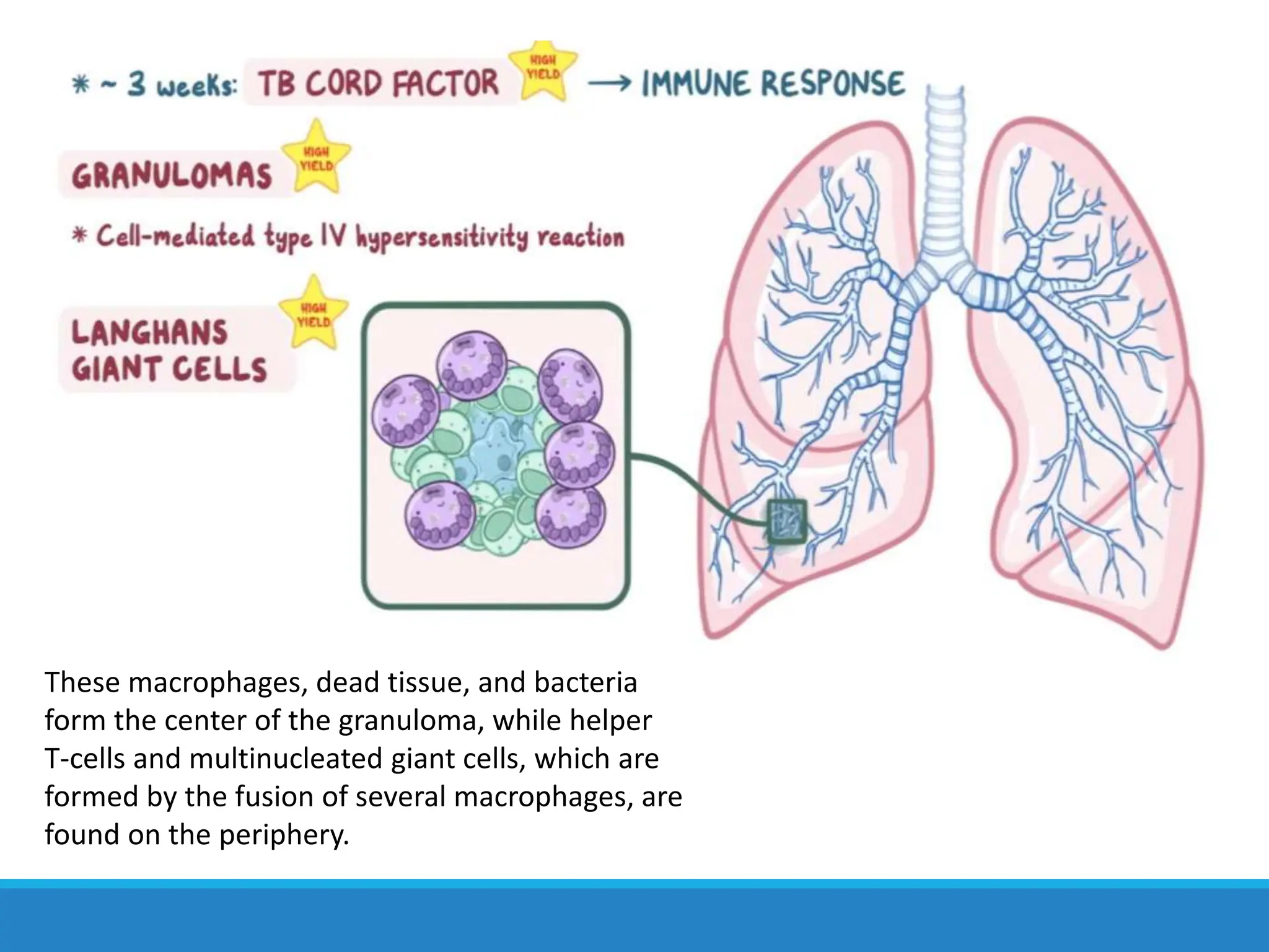11- Chronic inflammations -Tuberculosis.ppt