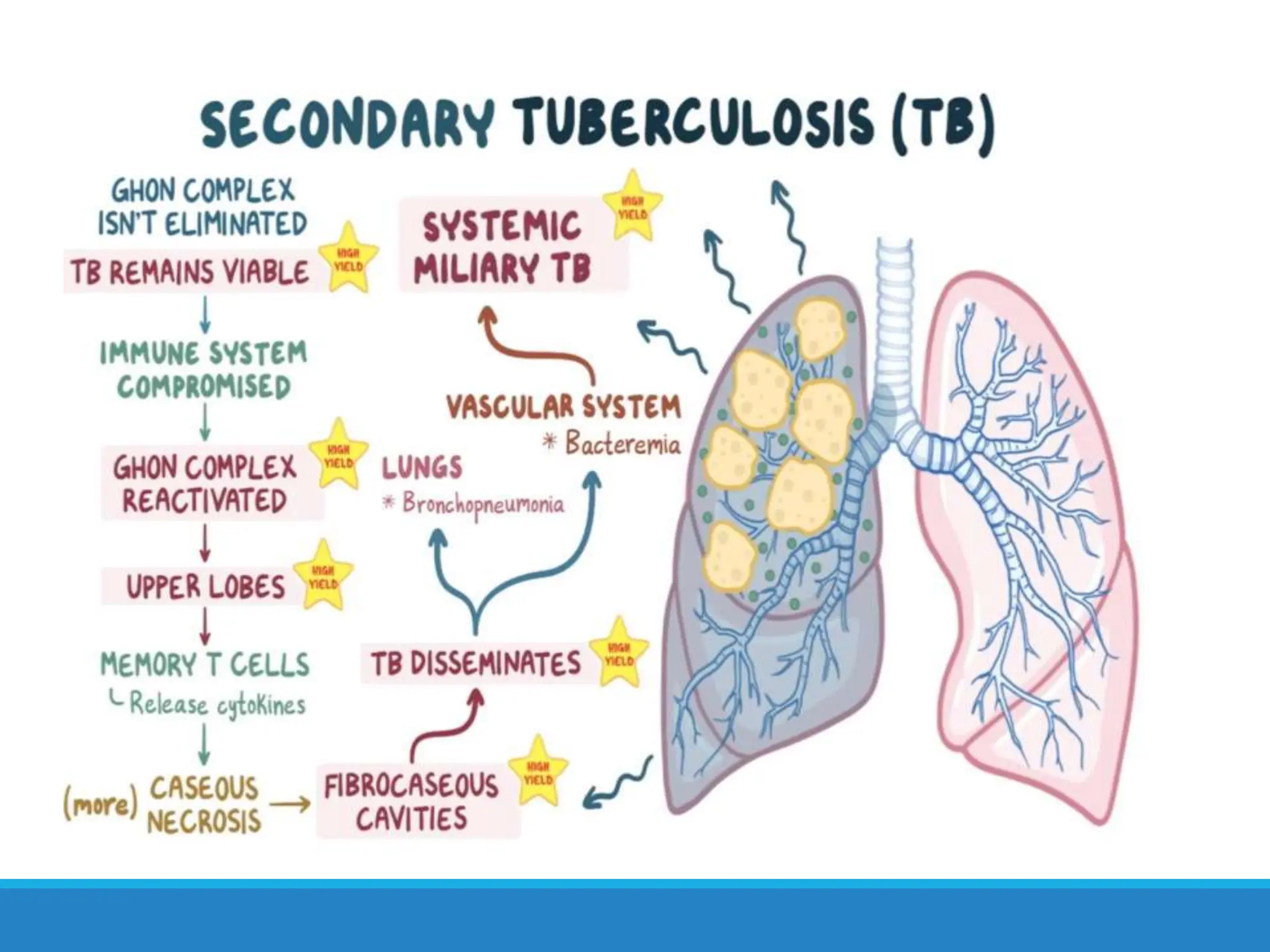 11- Chronic inflammations -Tuberculosis.ppt