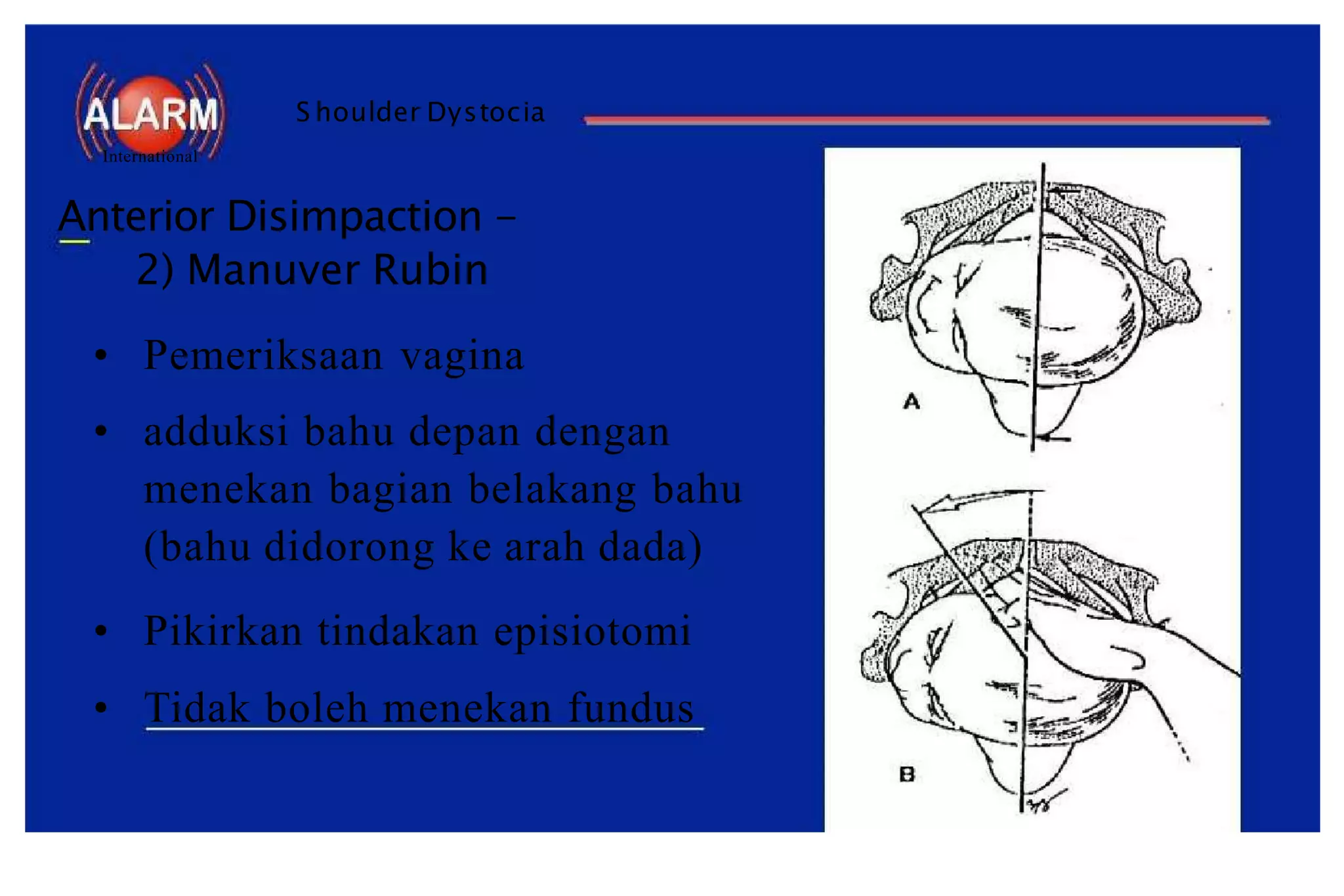 11-distosia-bahuppt.pptx