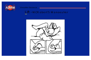 11-distosia-bahuppt.pptx