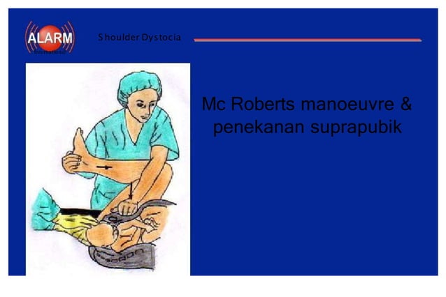 11-distosia-bahuppt.pptx