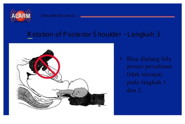 11-distosia-bahuppt.pptx