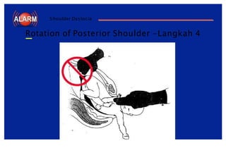 11-distosia-bahuppt.pptx