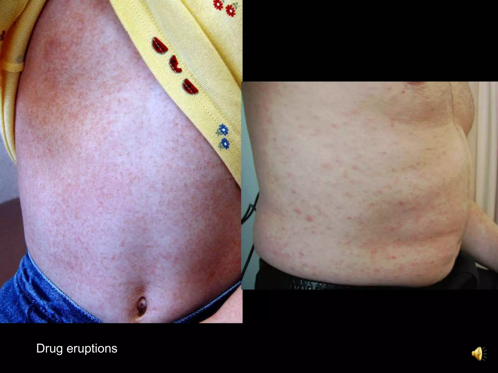 11. emergency dermatology | PPTX