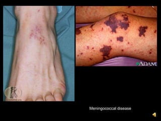 11. emergency dermatology | PPTX