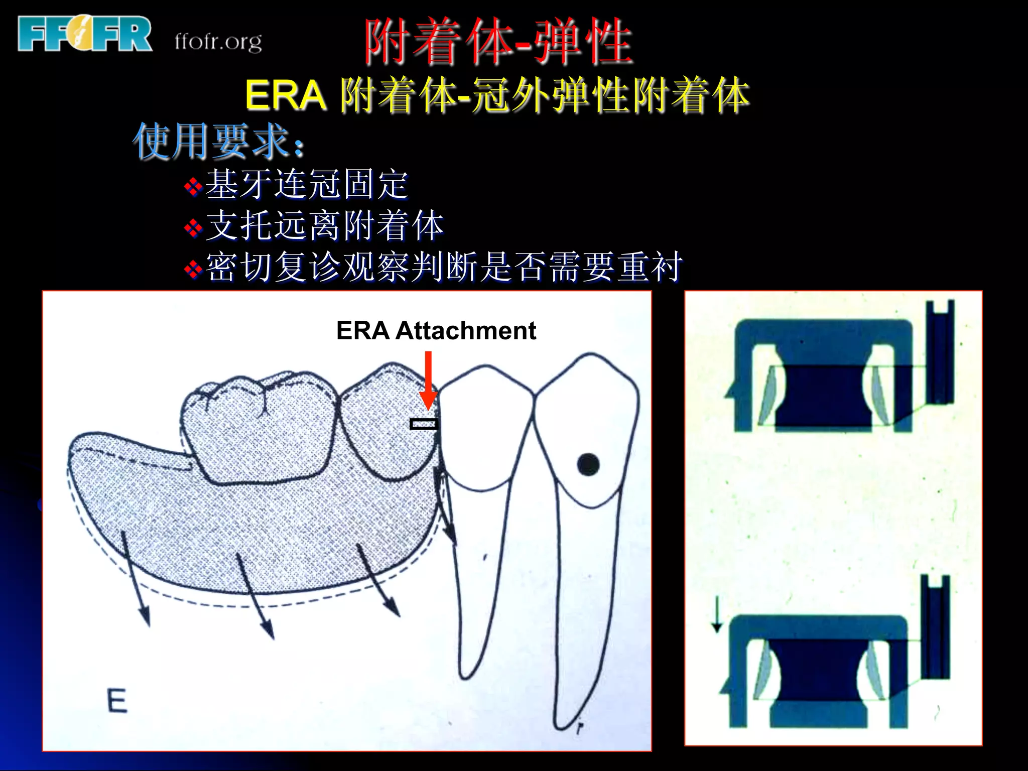 11.esthetics, rotational path, attachments | PDF