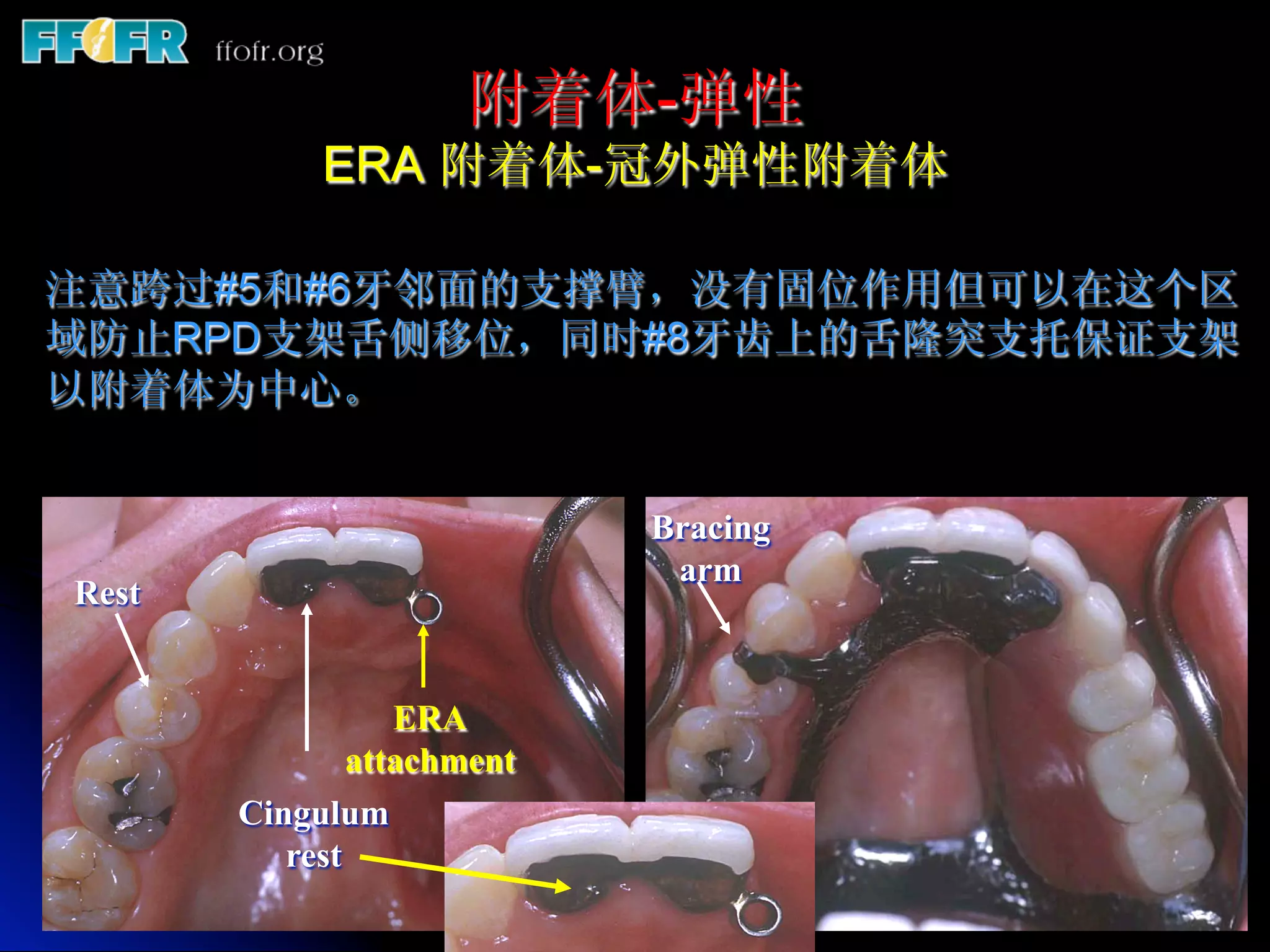 11.esthetics, rotational path, attachments | PDF