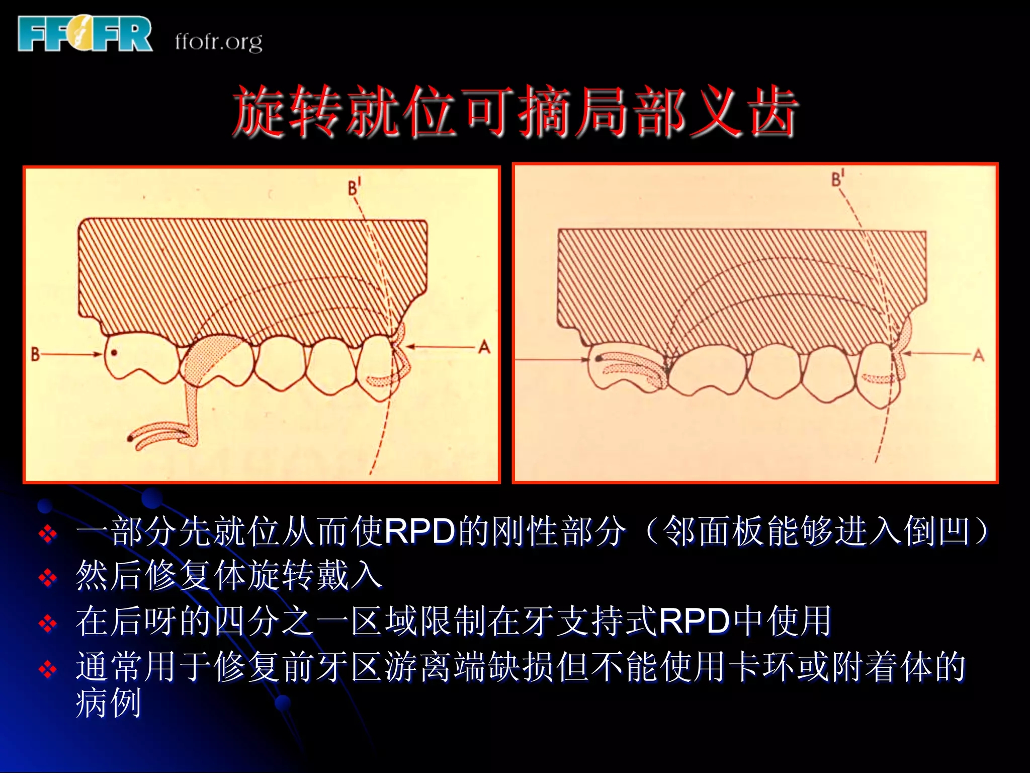 11.esthetics, rotational path, attachments | PDF