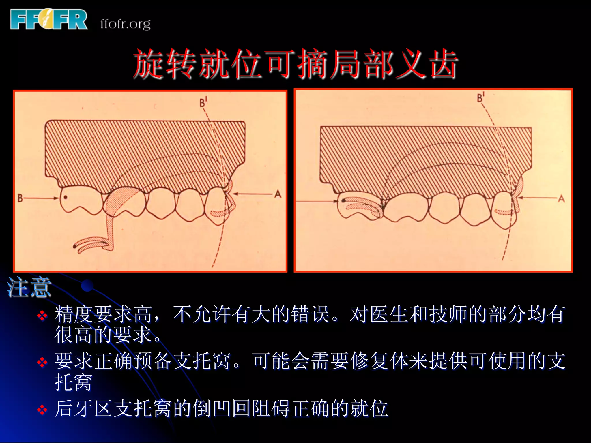 11.esthetics, rotational path, attachments | PDF