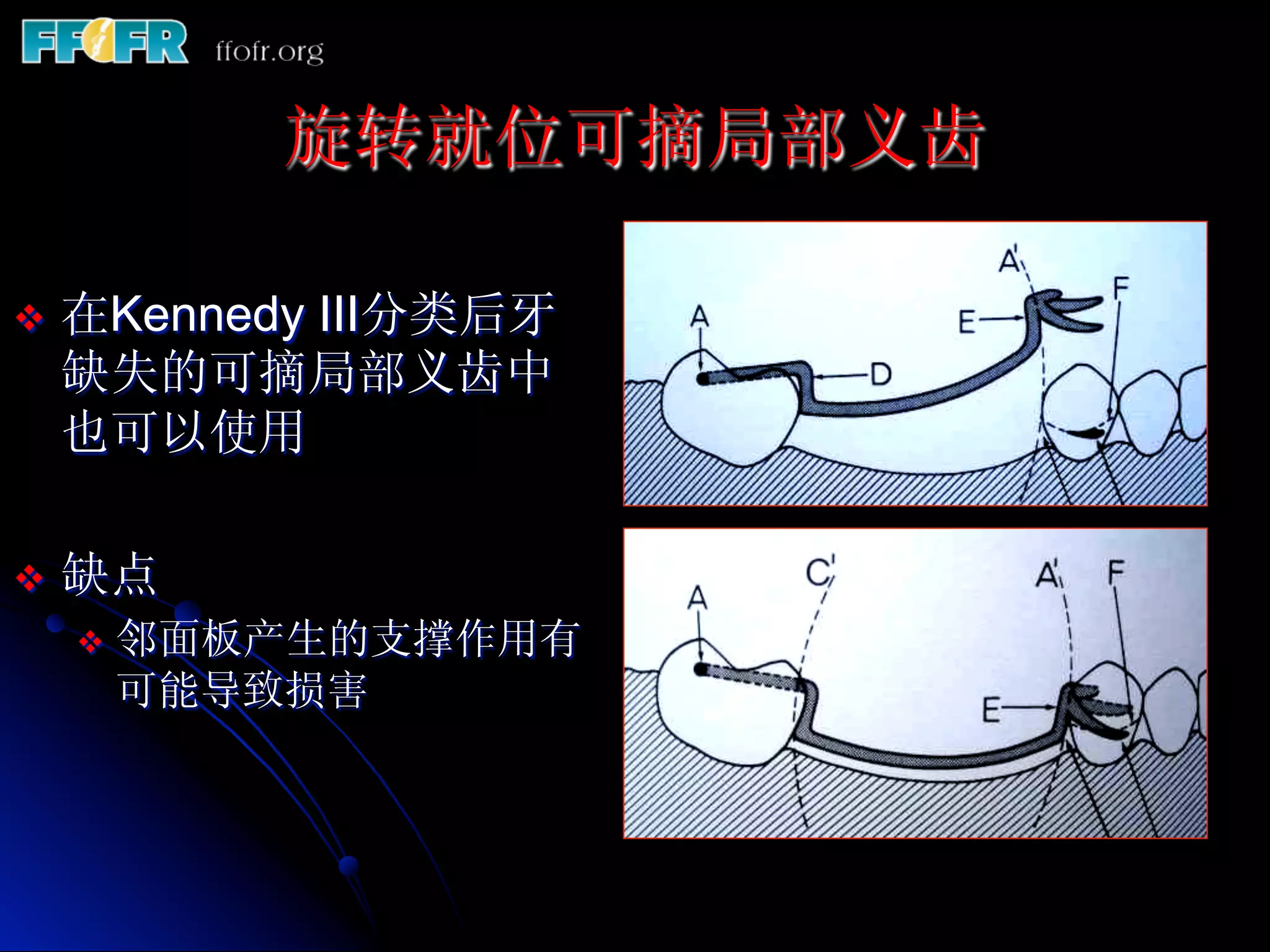 11.esthetics, rotational path, attachments | PDF