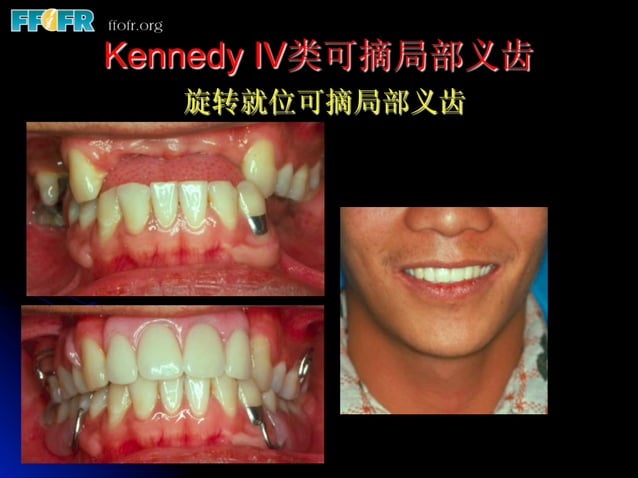 11.esthetics, rotational path, attachments | PDF