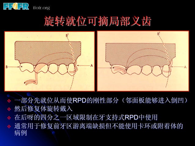 11.esthetics, rotational path, attachments | PDF