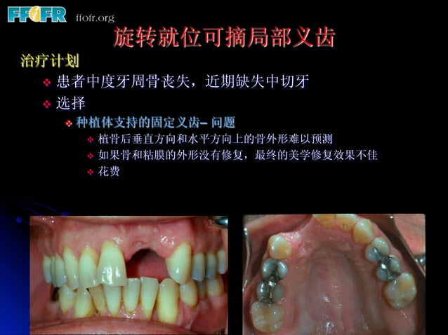 11.esthetics, rotational path, attachments | PDF
