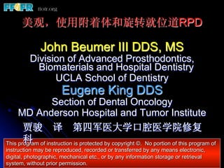 11.esthetics, rotational path, attachments | PPT