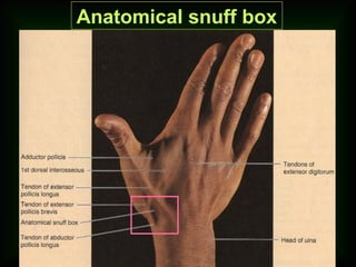 11-Extensor Muscle forearm introduction.ppt