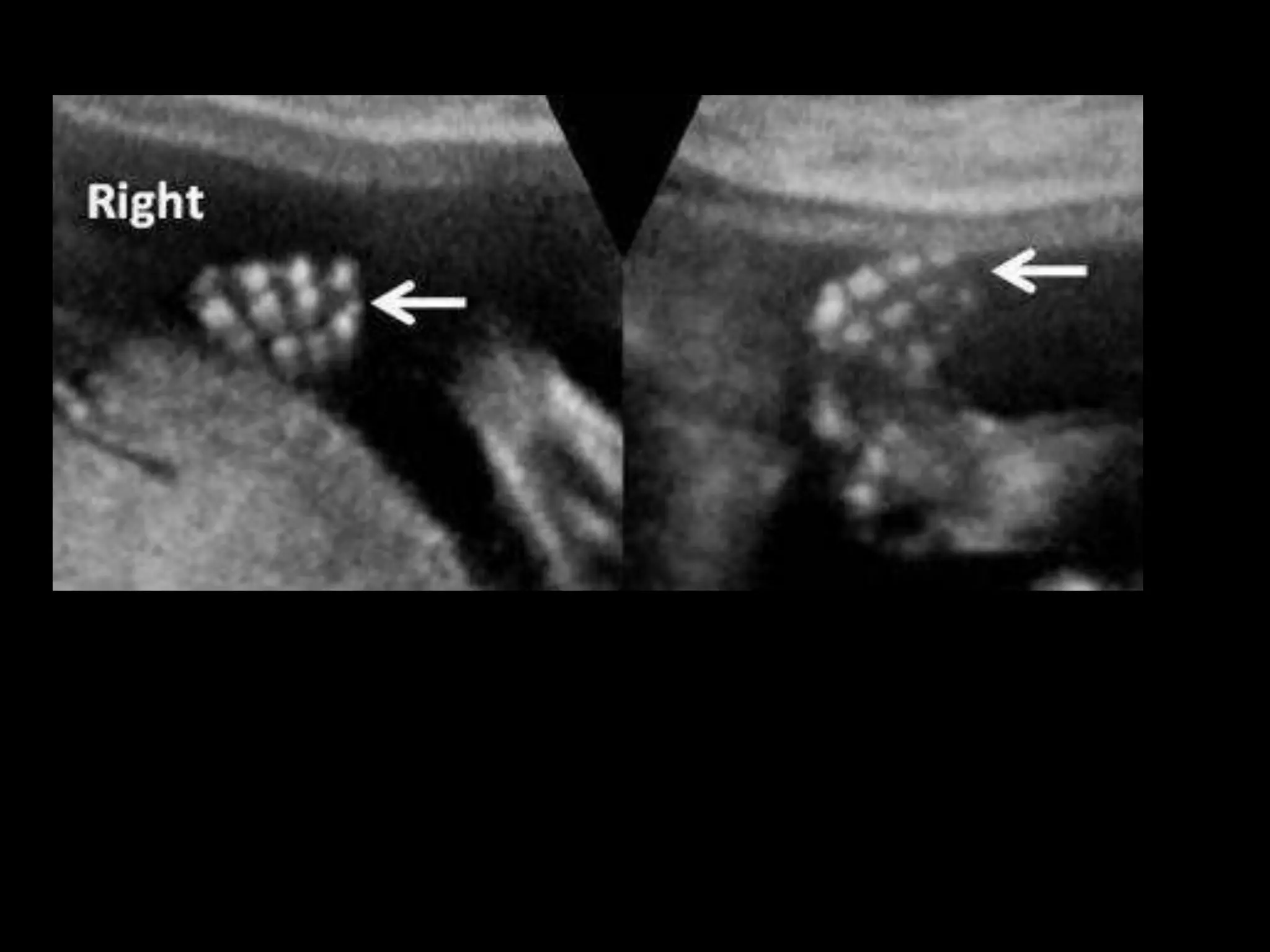 11-Fetal skeletal system part 2 Dr Ahmed Esawy | PPT