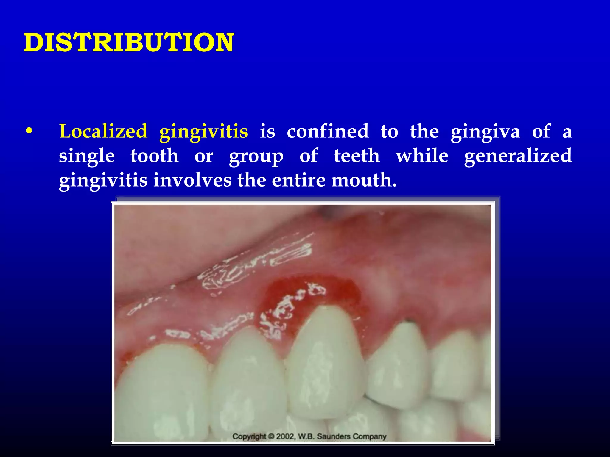 From Gingivitis to Periodontitis | PDF