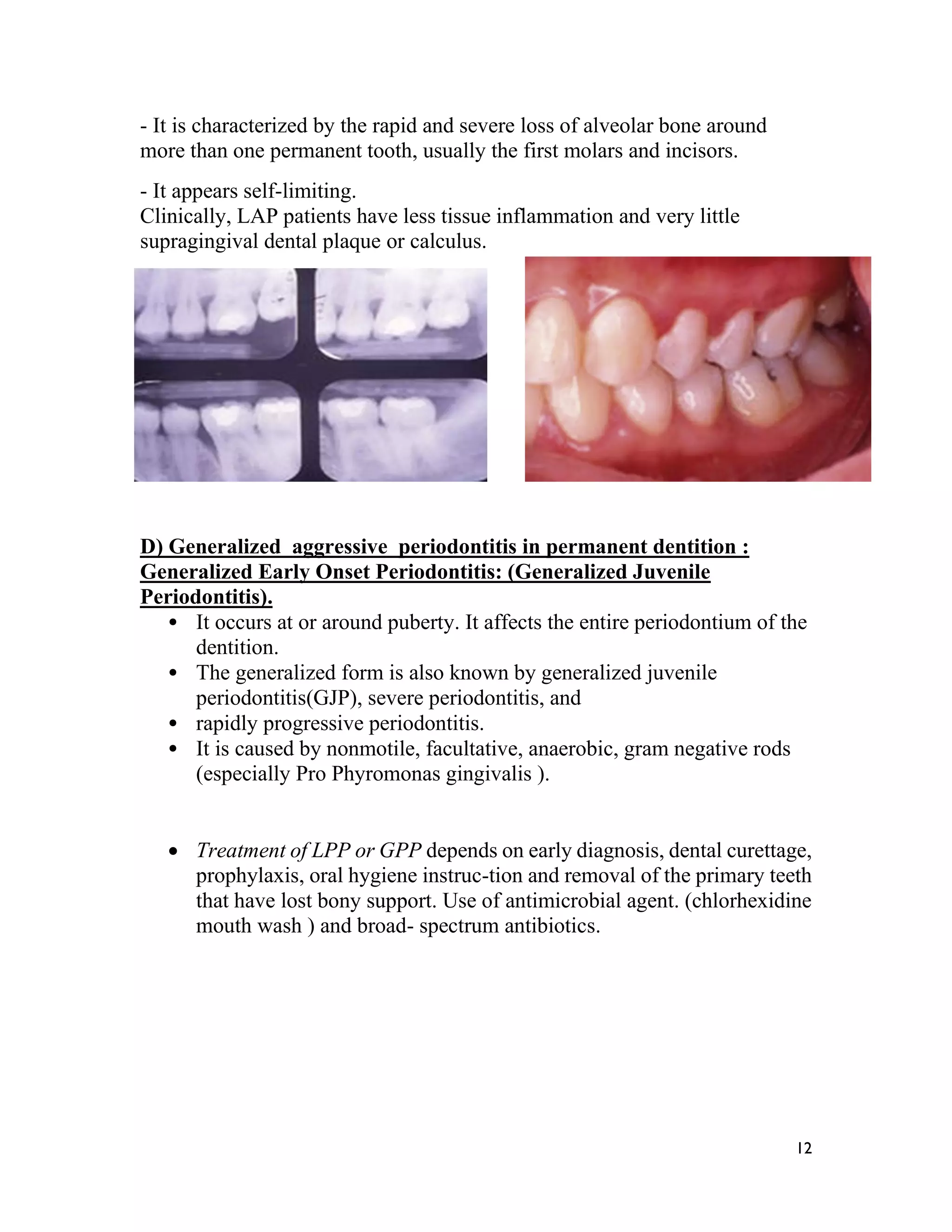 11- gingival and periodontal diseses.pdf
