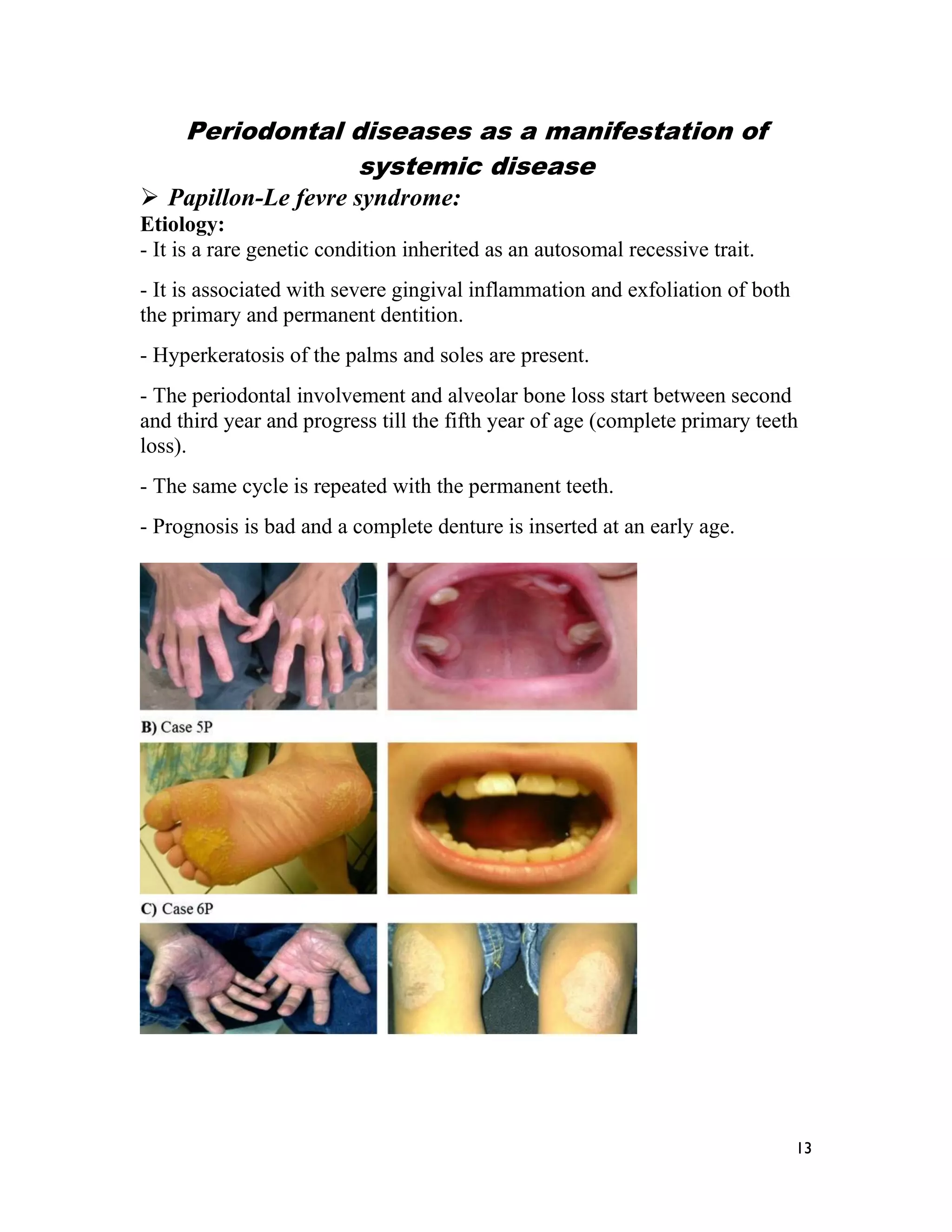 11- gingival and periodontal diseses.pdf