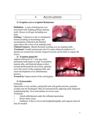 11- gingival and periodontal diseses.pdf
