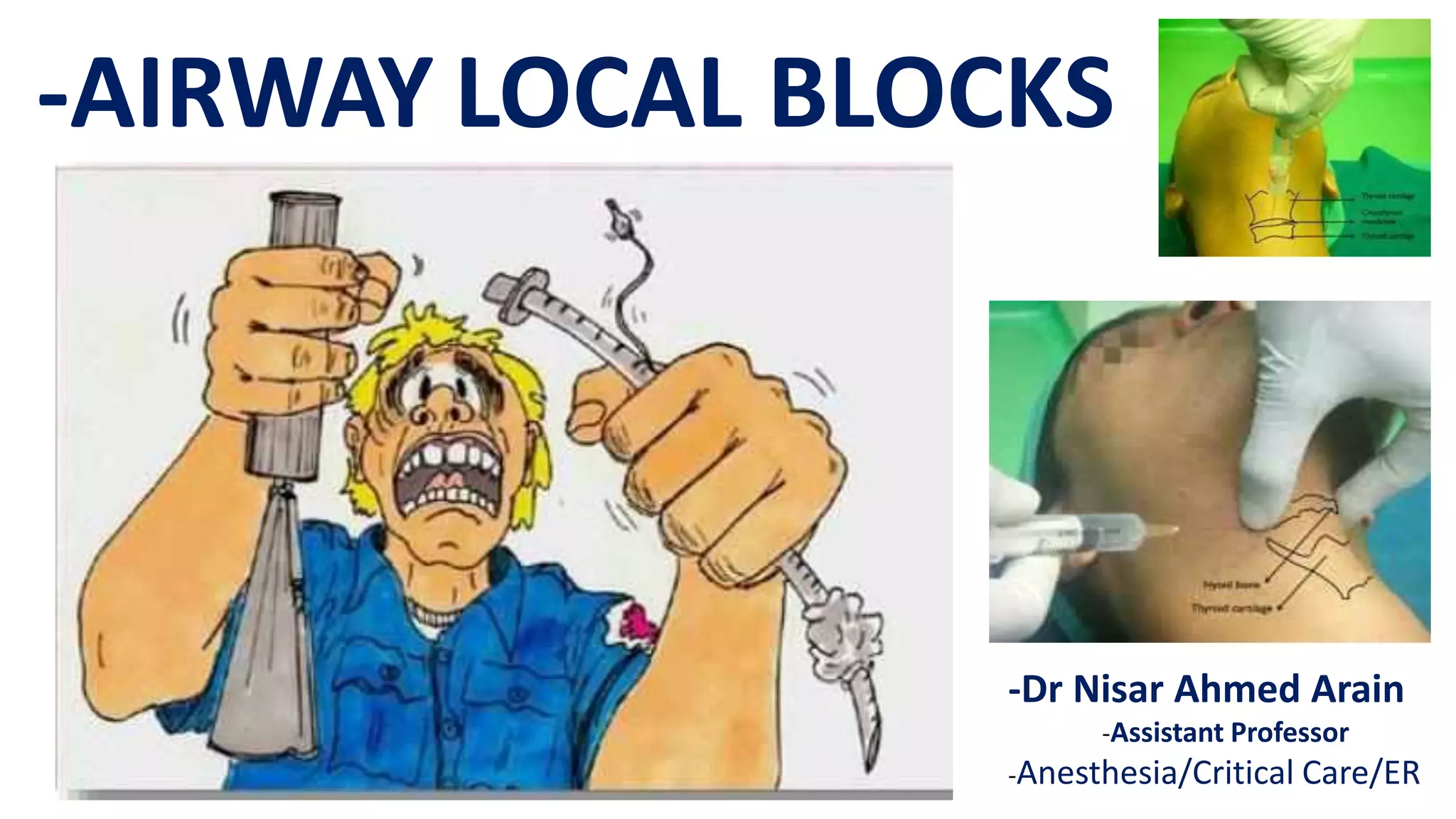 airway local blocks-Anesthesia | PPT