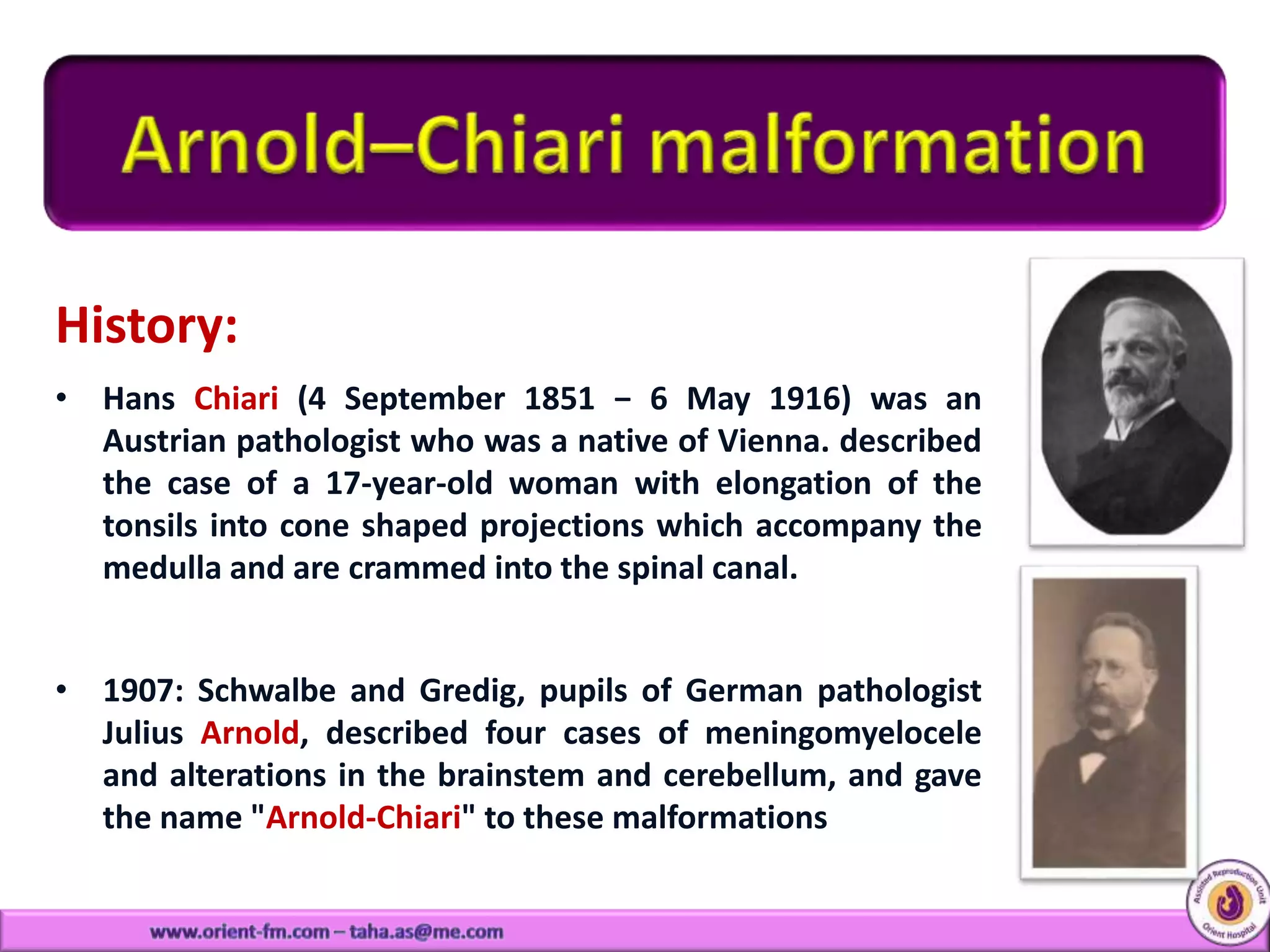 Malformations of Cerebellum | PPTX