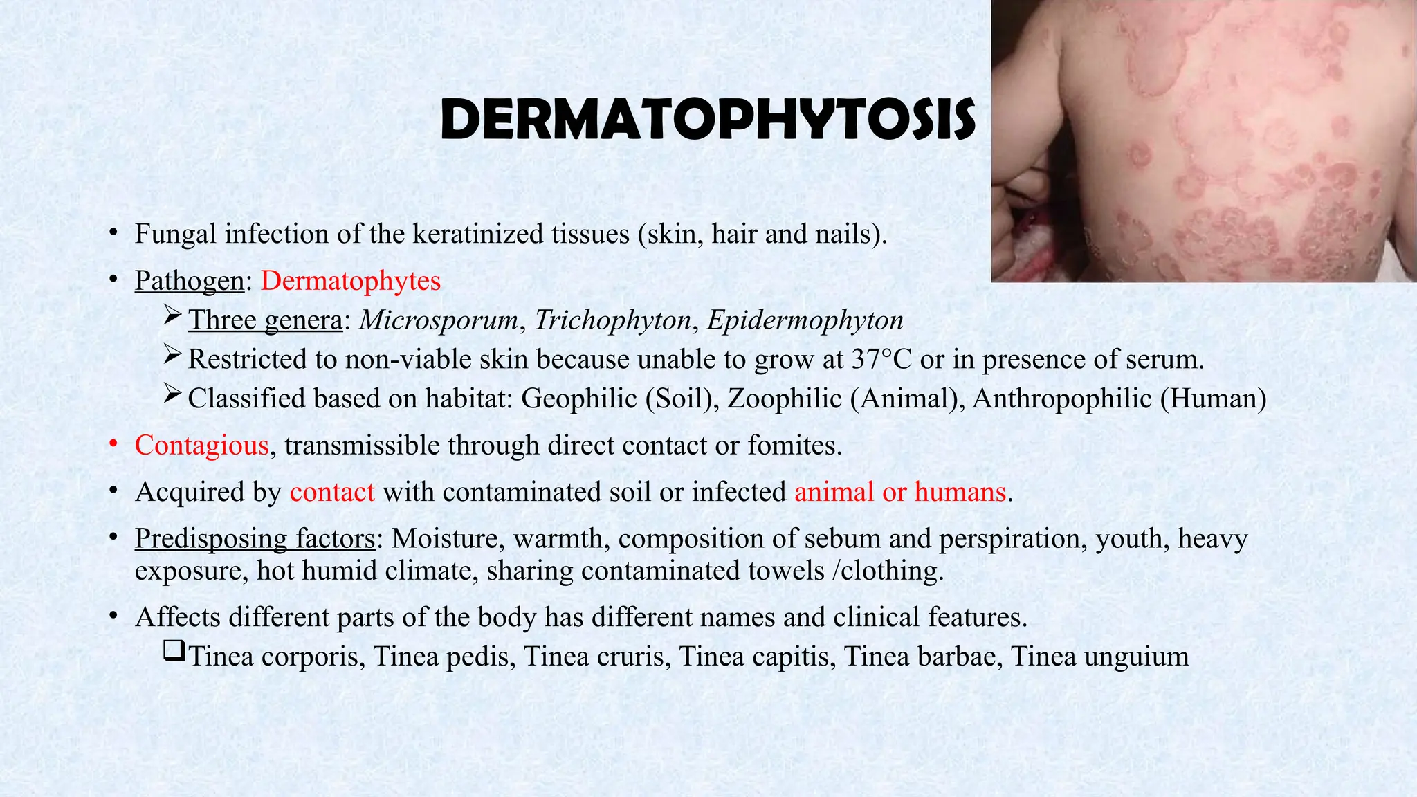 11 - Mycology Part 1.pptx 11 - Mycology Part 1.pptx | Skin and ...