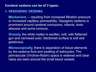 11-oedema.ppt