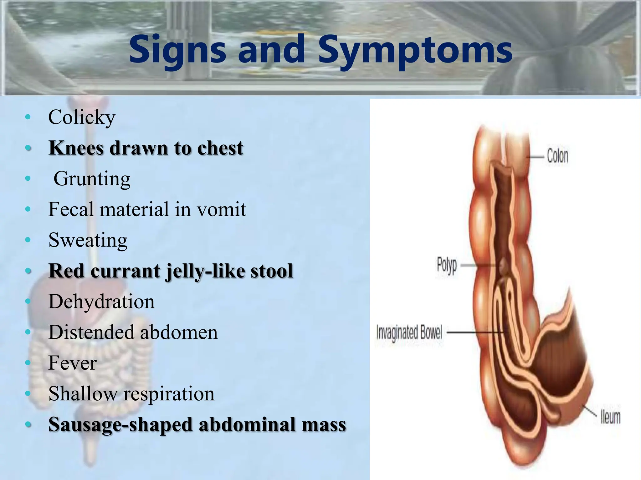 -11-The child with alterations in gastrointestinal functions.ppt