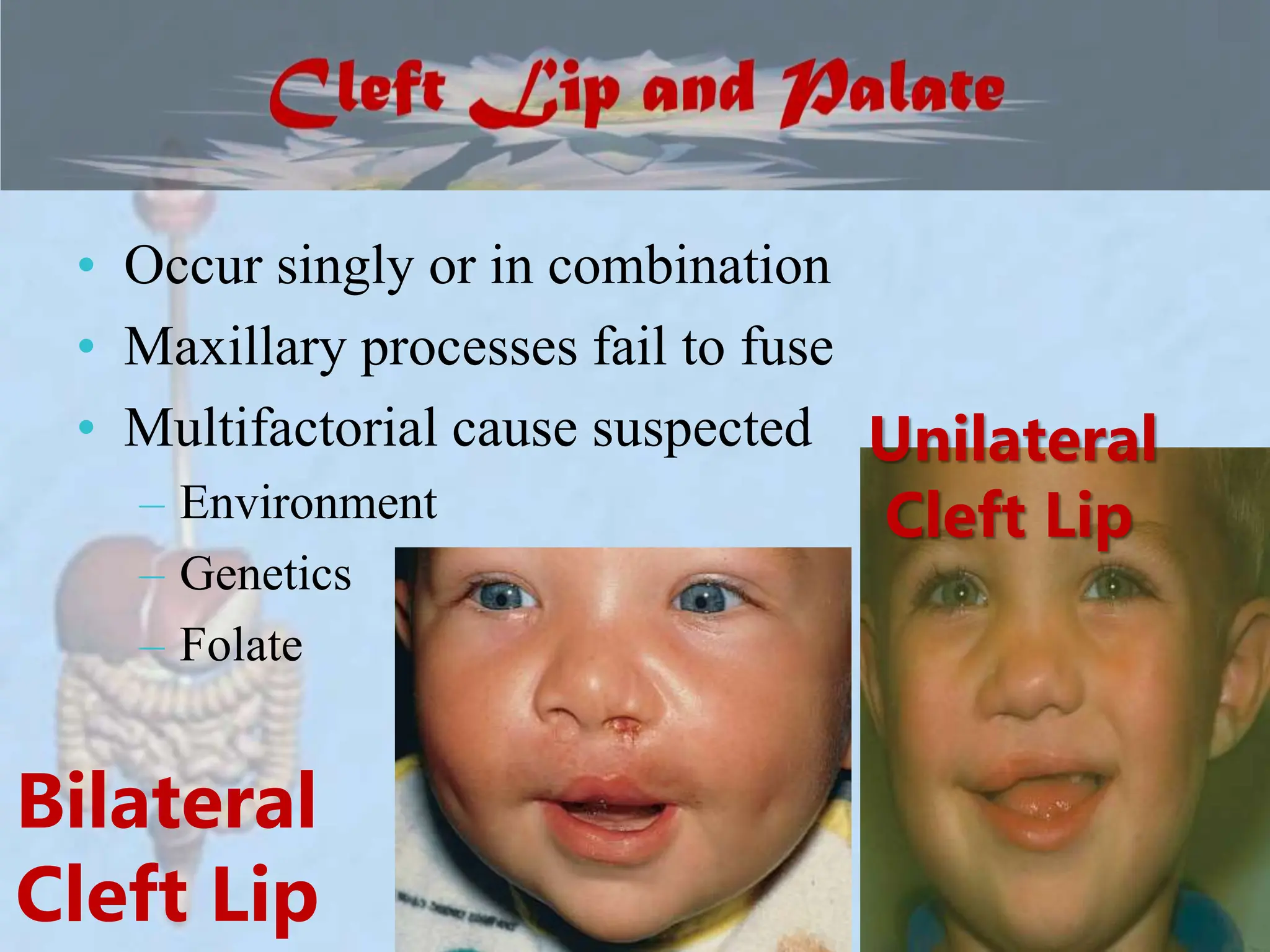-11-The child with alterations in gastrointestinal functions.ppt
