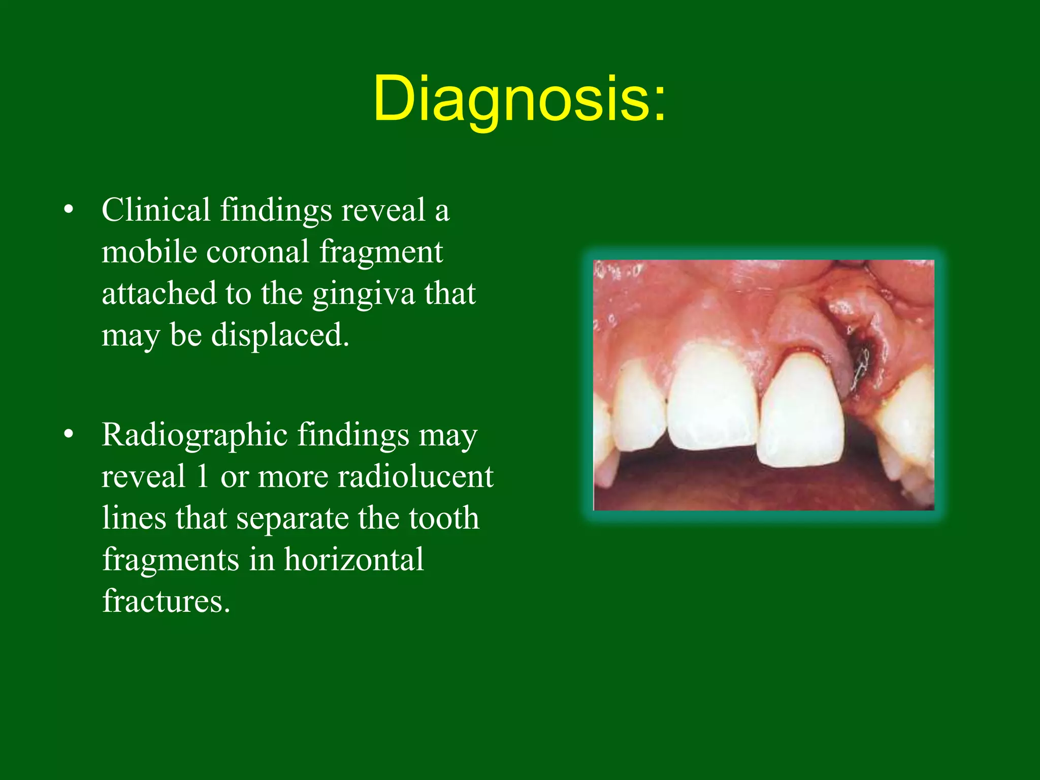 traumatic injuries in children: trauma to teeth and soft | PPTX