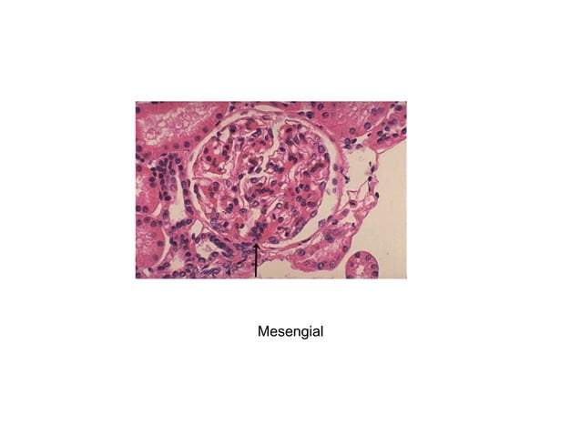 Pathology of The Urinary System | PPT