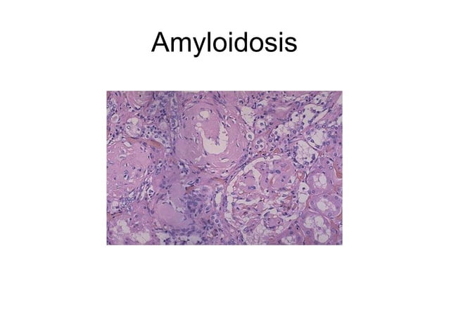 Pathology of The Urinary System | PPT