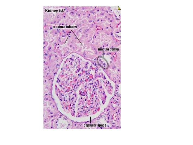 Pathology of The Urinary System | PPT
