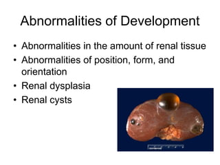 Pathology of The Urinary System | PPT