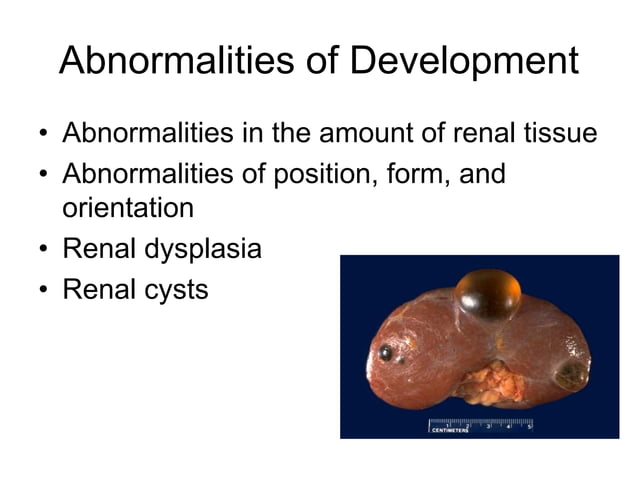 Pathology of The Urinary System | PPT