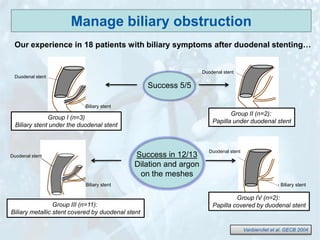 Endoscopy in Gastrointestinal Oncology - Slide 11 - G. Vanbiervliet ...