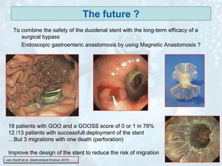 Endoscopy in Gastrointestinal Oncology - Slide 11 - G. Vanbiervliet ...