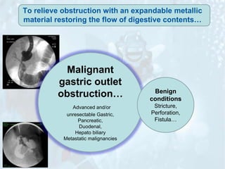 Endoscopy in Gastrointestinal Oncology - Slide 11 - G. Vanbiervliet ...
