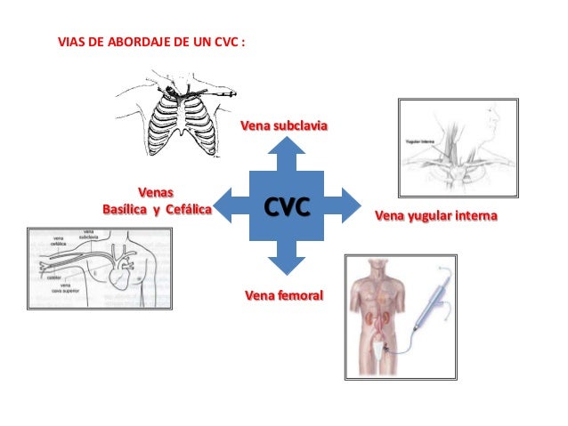 Mantenimiento de los accesos venosos centrales - CICAT-SALUD