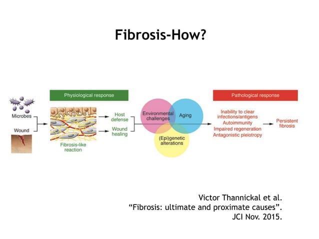 Fibrotic Diseases | PPT