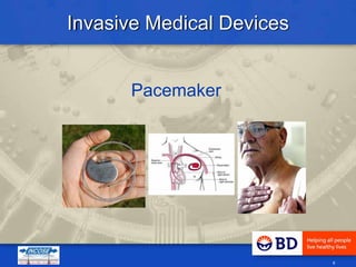 Systems Engineering in Medical Devices | PDF