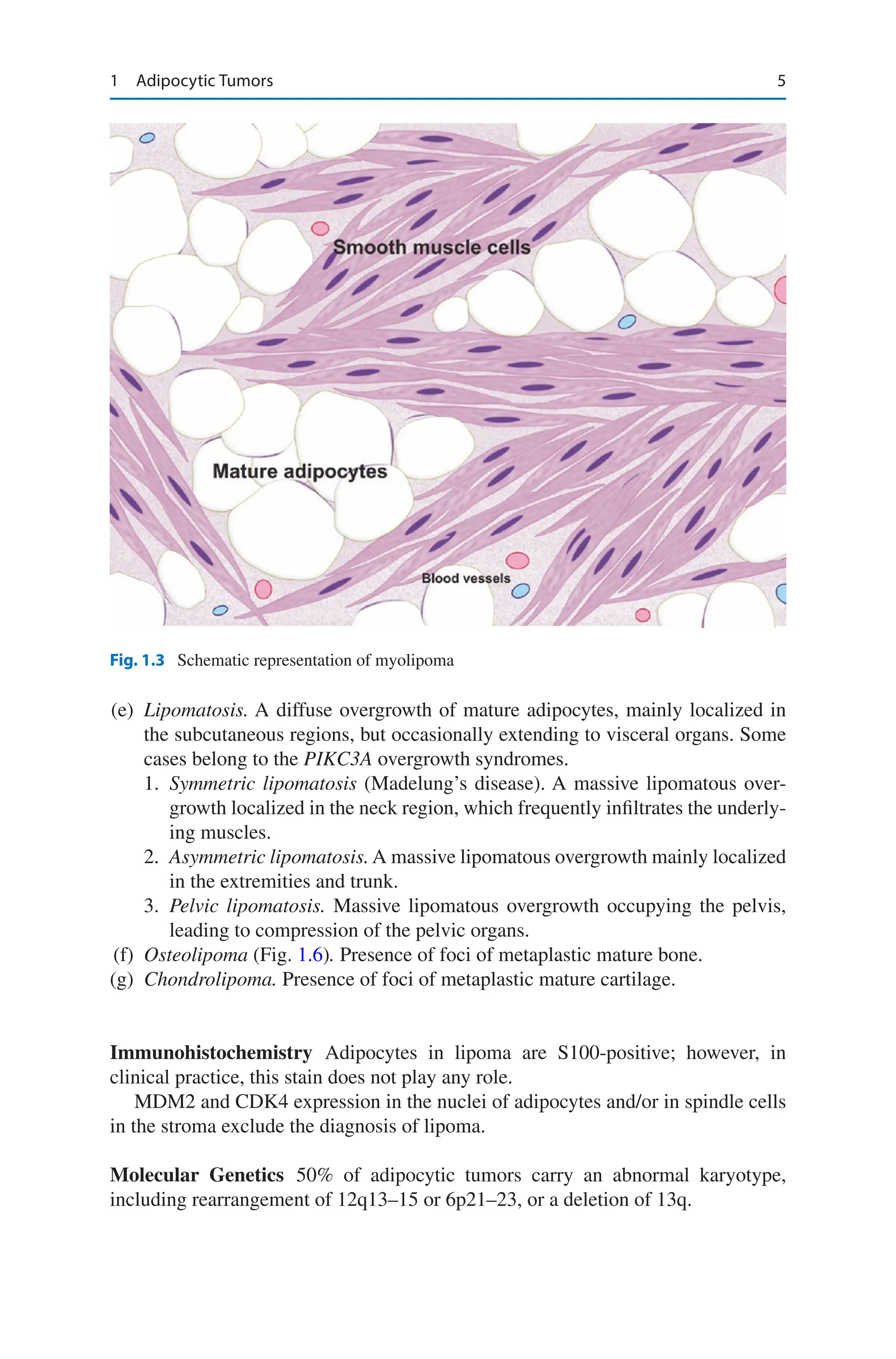 Adipocytic Vascular And Skeletal Muscle Tumors A Practical Diagnostic ...