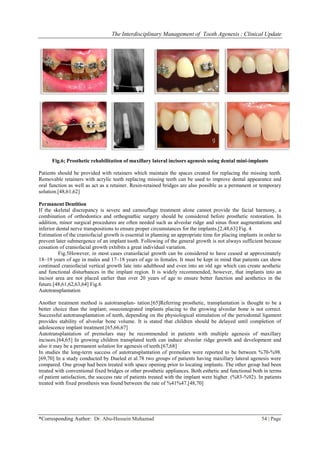 The Interdisciplinary Management of Tooth Agenesis; Clinical Update | PDF